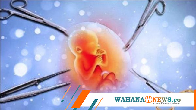 Bahaya Aborsi bagi Kesehatan Reproduksi Wanita - Wahana News