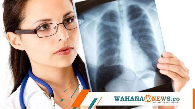Waspadai Jamur Candida Auris untuk Kesehatan, Bisa Tumbuh di Paru-Paru ...