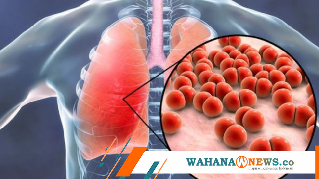 Kewaspadaan Terhadap Pneumonia Akibat 'Mycoplasma Pneumoniae' Pada Anak ... Kewaspadaan Terhadap Pneumonia Akibat 'Mycoplasma Pneumoniae' Pada Anak ...
